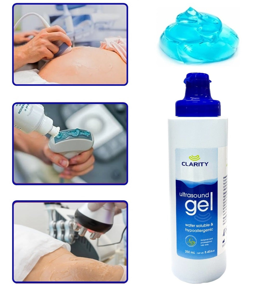 Buy Blue Ultrasound Gel Online | SOLMED – Solmed Medical Supplies