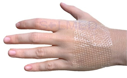 Sofmesh Silicone Wound Contact Layer | SOLMED – Solmed Medical Supplies